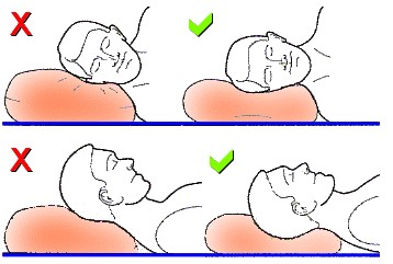 Sleeping postures | Essential Health Plus